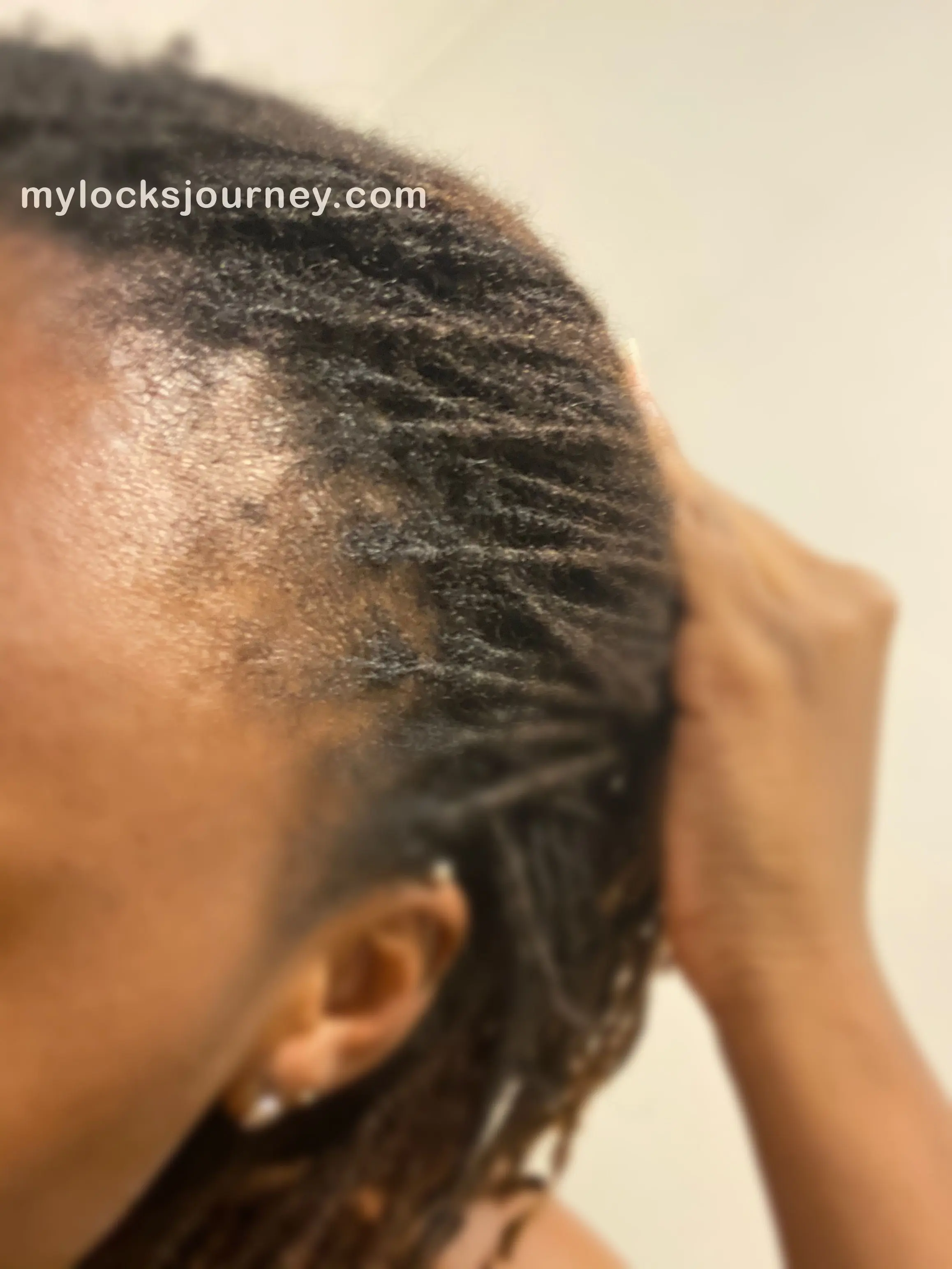 Thinning hair Dos and Don'ts: Fix thin edges - My Locks Journey